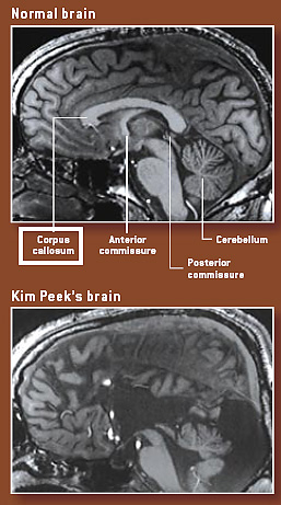 Sacramento State - Anatomy and Physiology Blog: An old story but ...