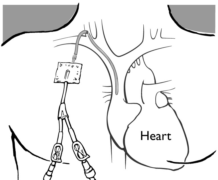 Good Design Gone Bad.....: What does one boob, "happy juice" & Bob ...