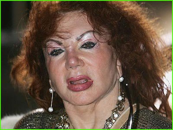 My Funny: The Good Surgeon Guide's Top 10 Ugliest Celebrities | Pictures