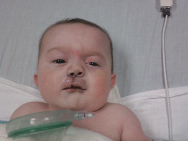 SuperDoug: Previous posts and updates from CarePages