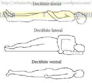 Decúbito Ventral