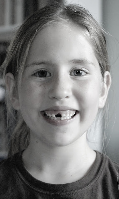 Moss Moments: real LIVE orphans...