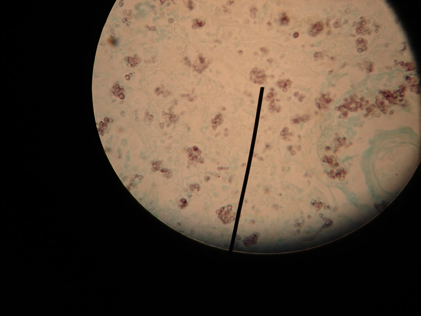Microbiology: Systemic fungi