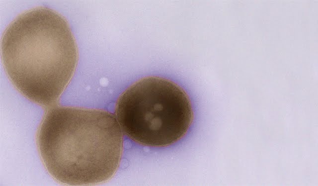 Giulio Prisco: First Self-Replicating Synthetic Bacterial Cell