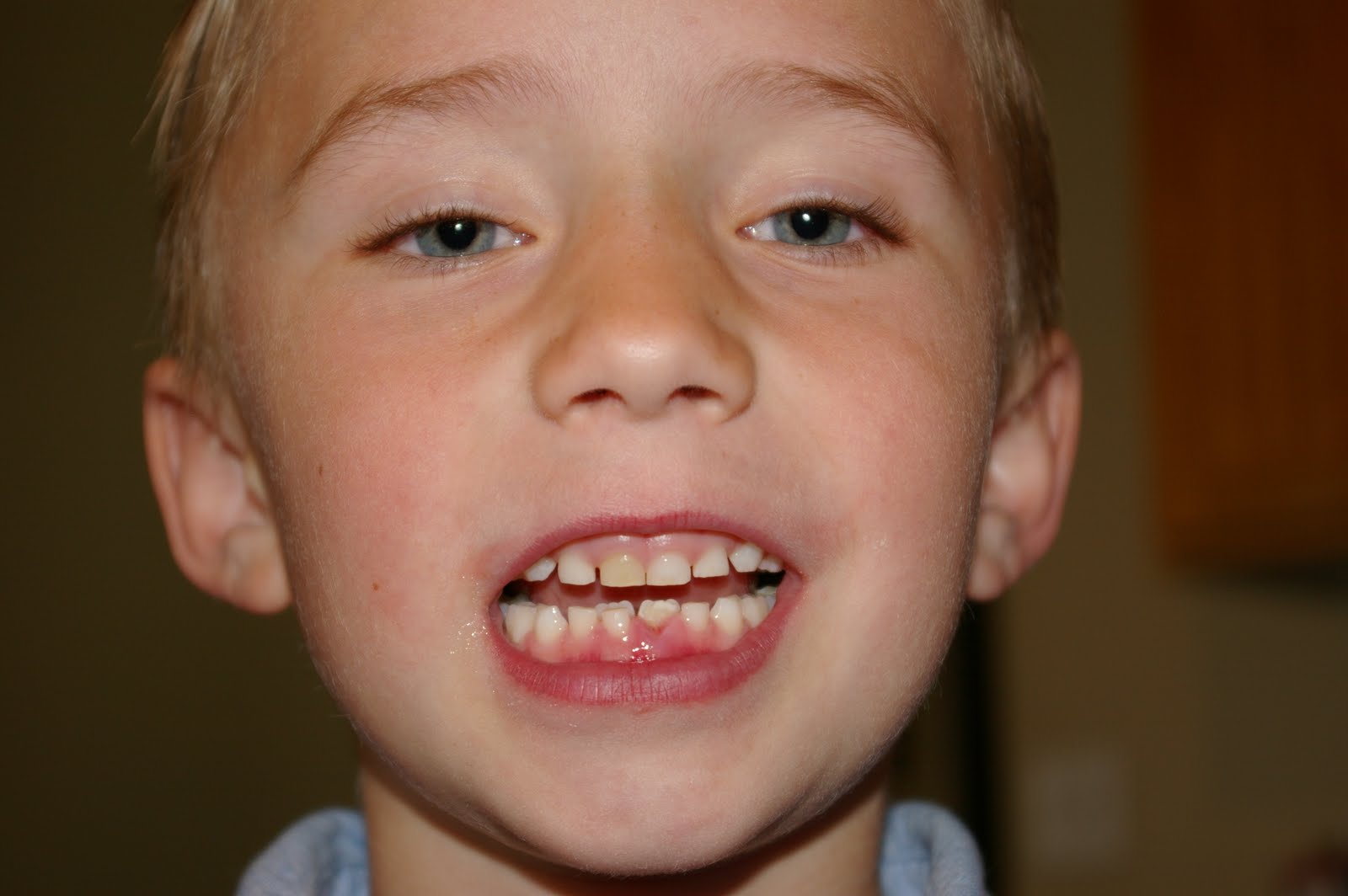 Count Your Blessings: Nick's First Lost Tooth!