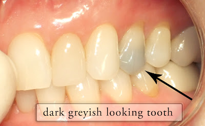 Floss n' Blog: Dark trouble!