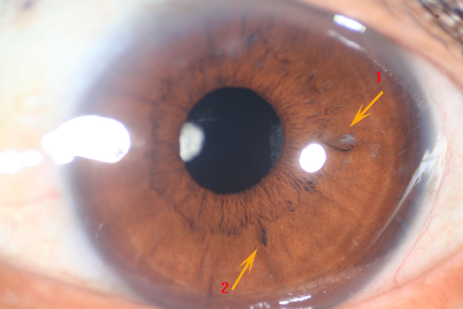 Modern & Multidimensional Iridology: Iridology Analysis - 40