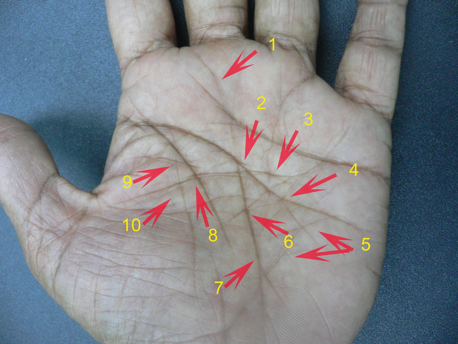 Modern & Multidimensional Iridology: Medical Palmistry Analysis