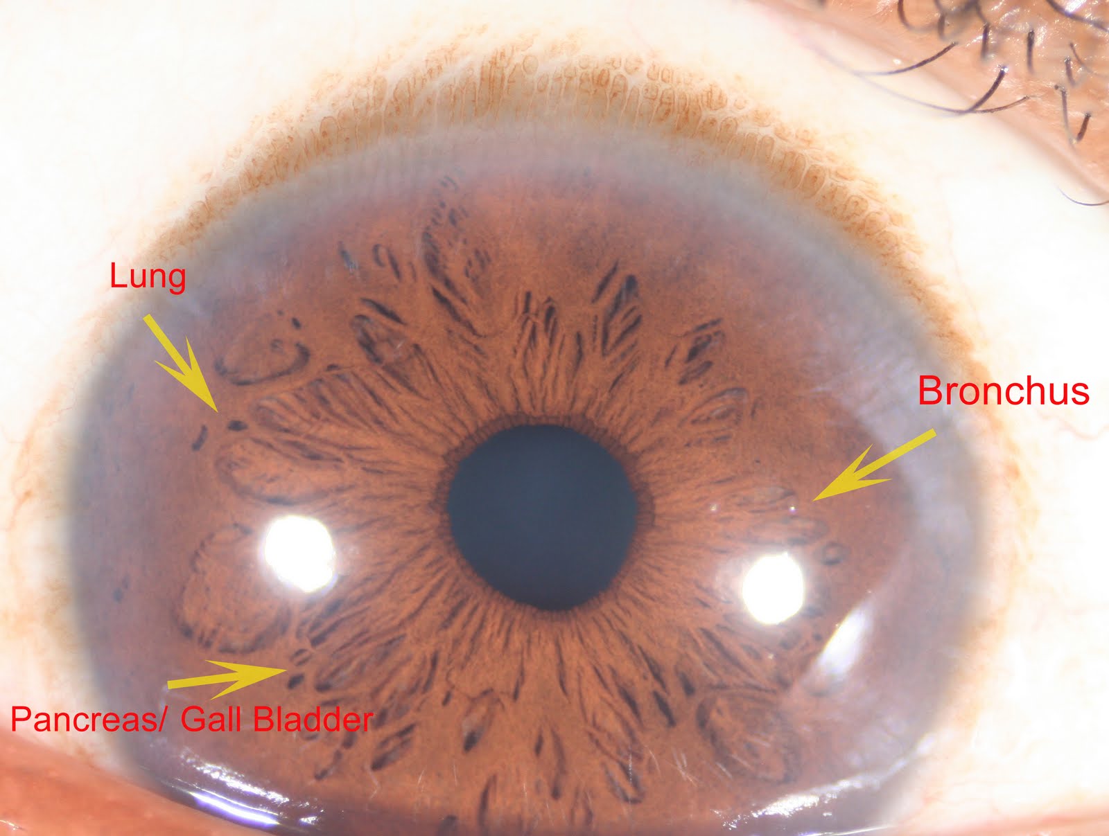 Modern & Multidimensional Iridology: Multidimensional Iridology ...