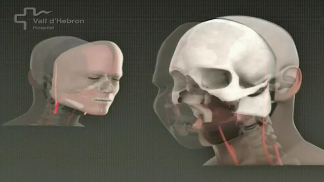 doctors videos backup: World's first full face transplant carried out