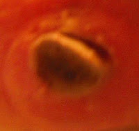 .: Cansema - The Cancer Curing Black Salve