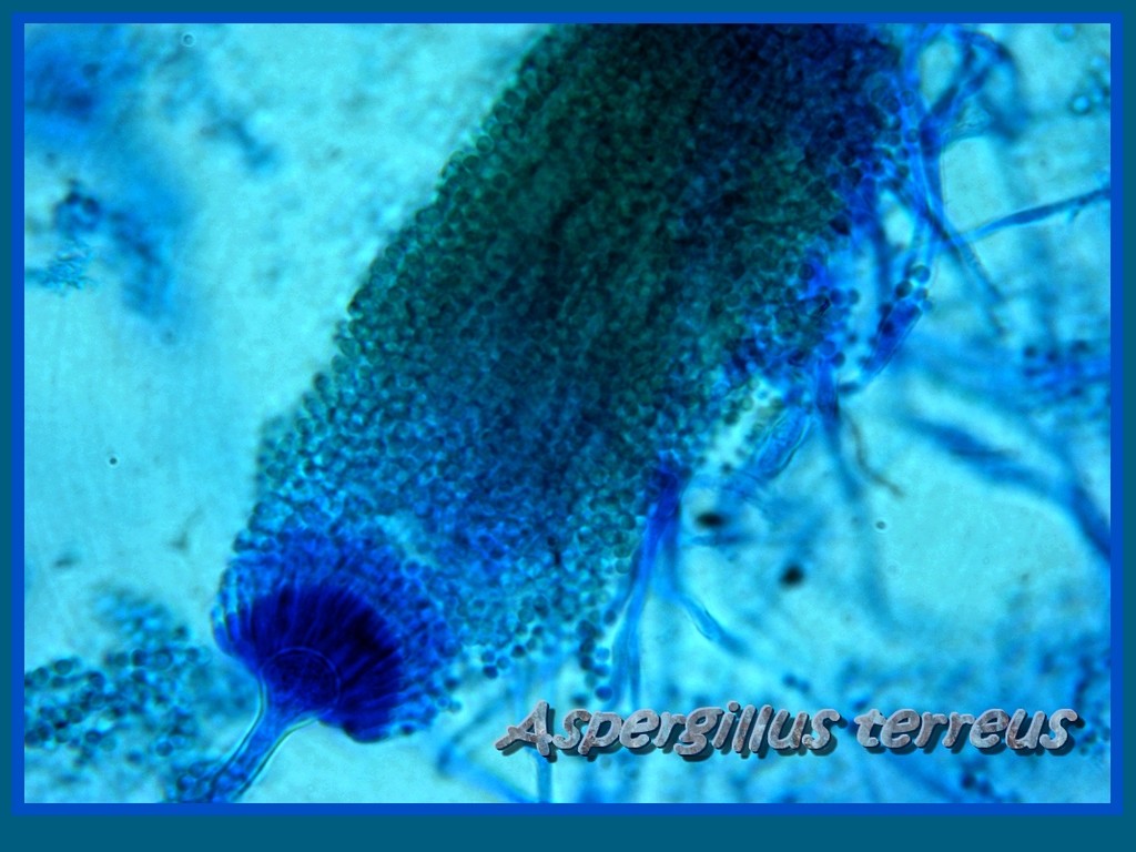 Fun With Microbiology (What's Buggin' You?): Aspergillus terreus