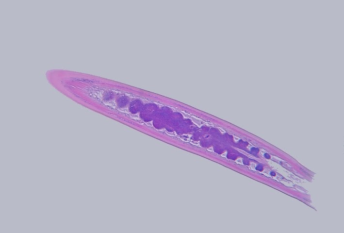 Fun With Microbiology (What's Buggin' You?): Whipworm (Trichuris trichiura)