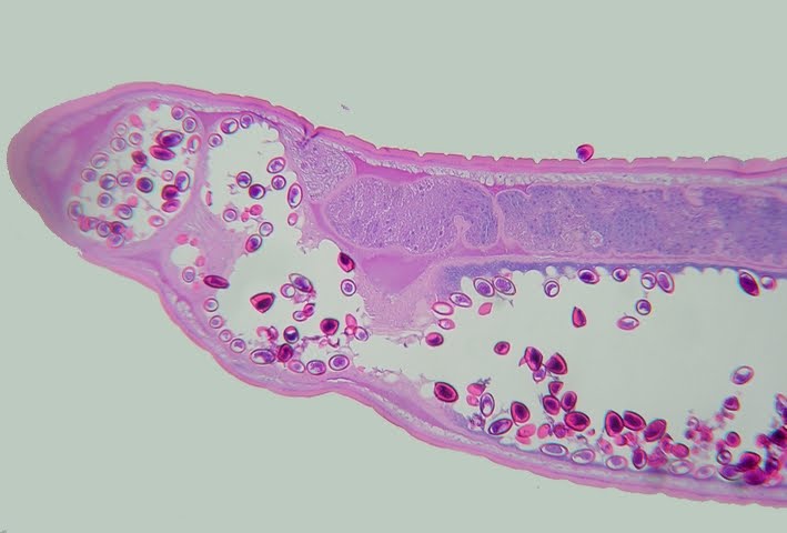 Fun With Microbiology (What's Buggin' You?): Whipworm (Trichuris trichiura)