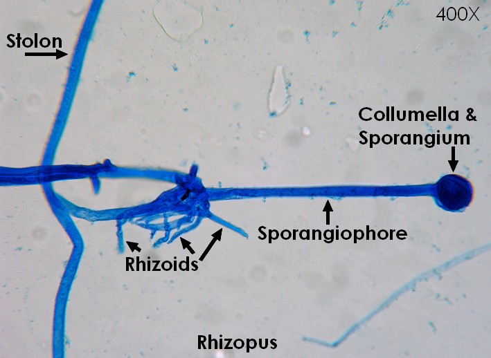 Fun With Microbiology (What's Buggin' You?): Rhizopus species