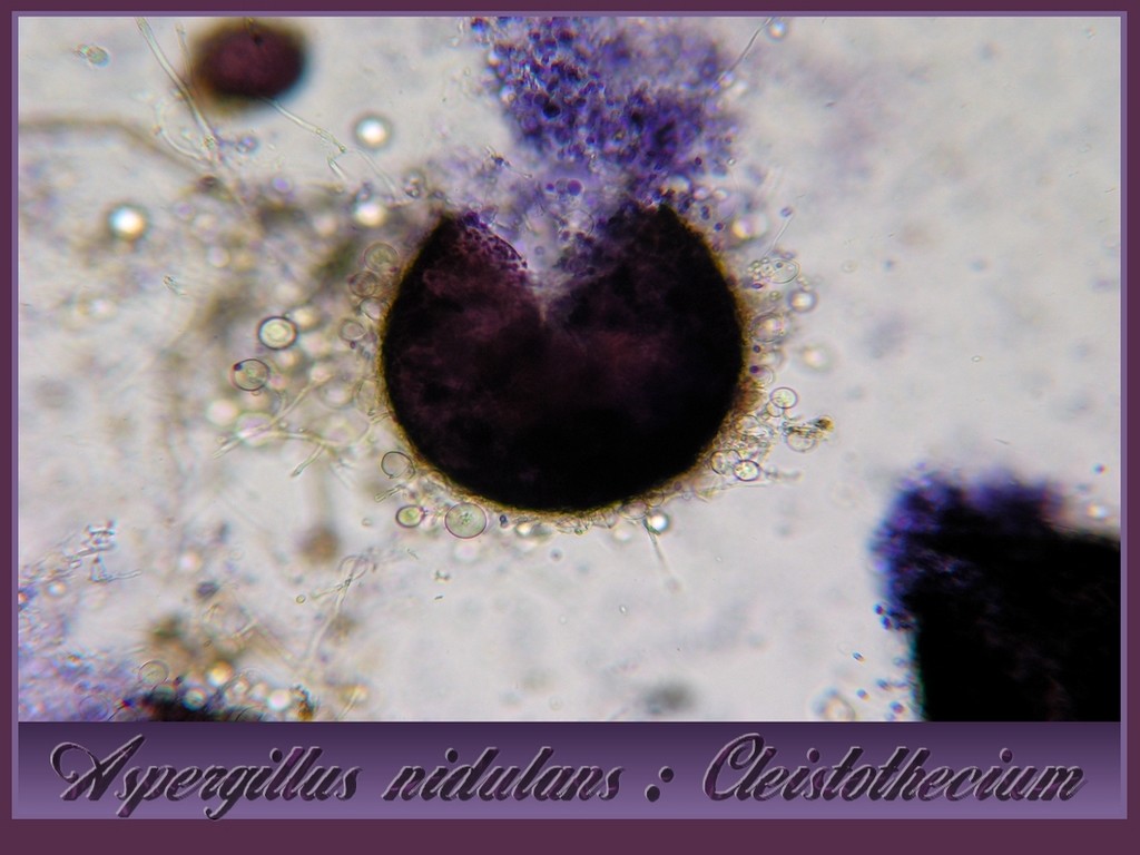 Fun With Microbiology (What's Buggin' You?): Aspergillus nidulans ...