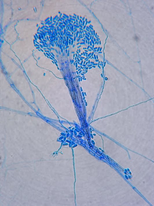 Fun With Microbiology (What's Buggin' You?): Pseudallescheria boydii ...