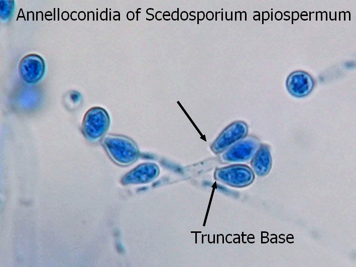 Fun With Microbiology (What's Buggin' You?): Pseudallescheria boydii ...