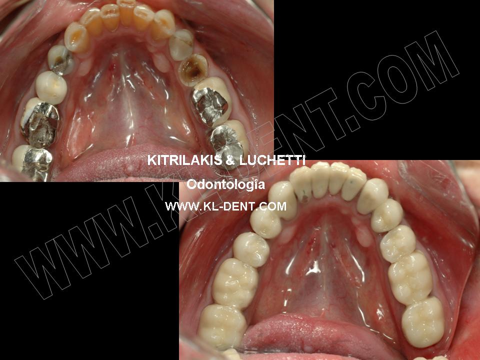 Kitrilakis & Luchetti - Dentistry: Fixed Prosthodontics: Complete ...