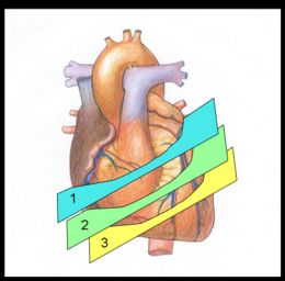 Cardiology Blog: Echocardiography Imaging Windows - The Parasternal Window