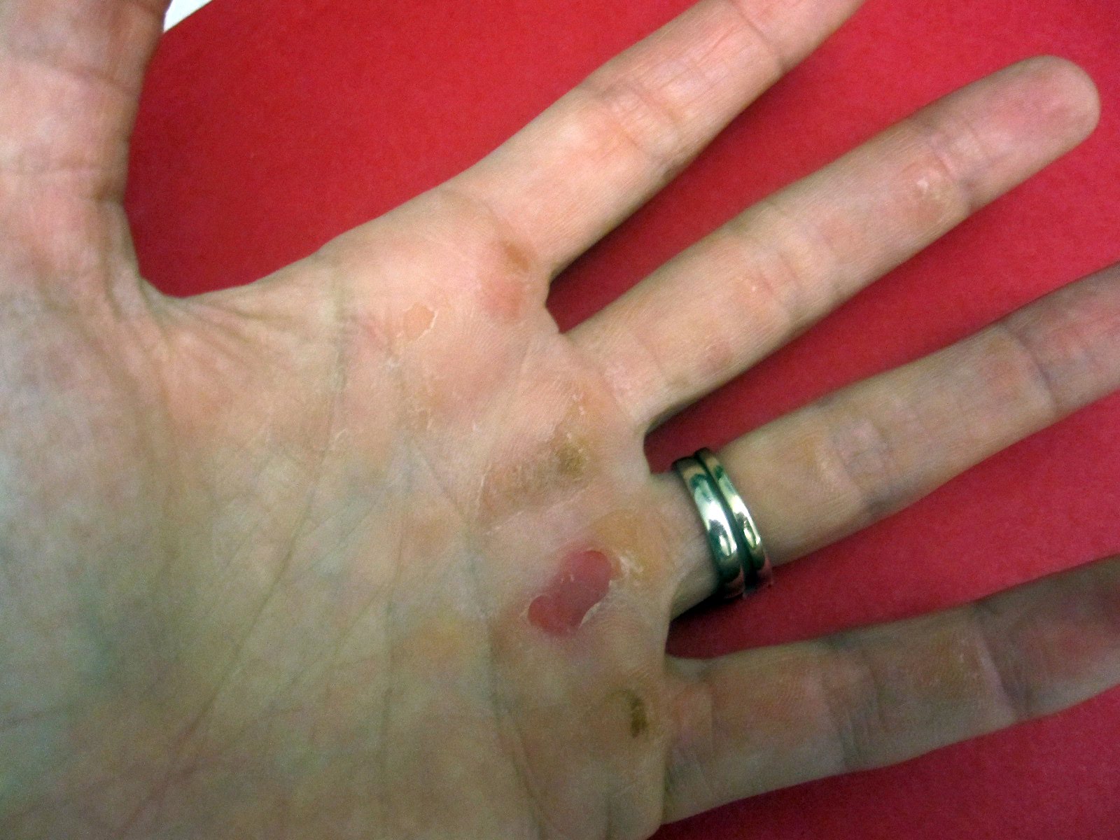 tear and repair - The Hobson Homestead