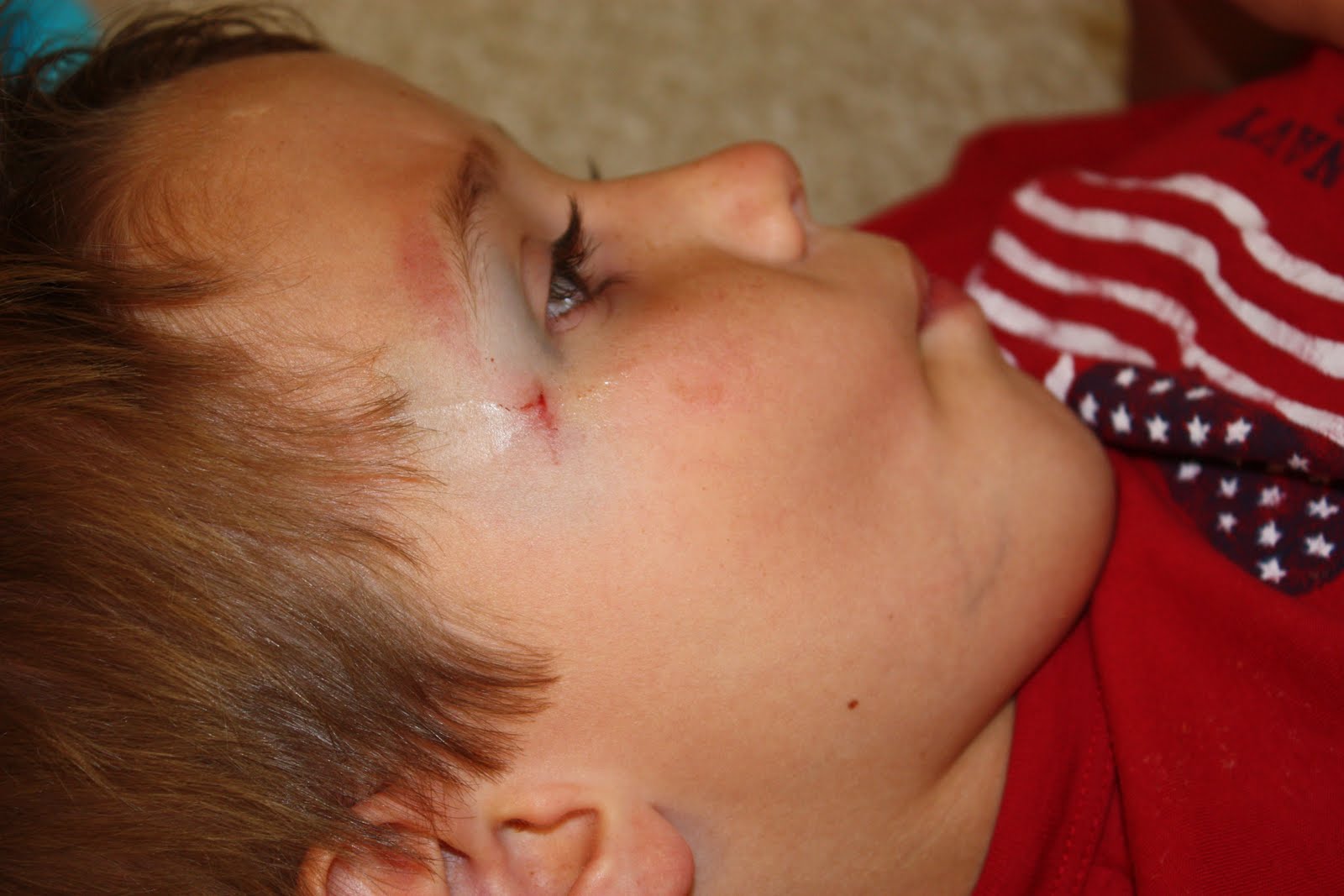 Under the Farmhouse Roof: Little Boys & Injuries