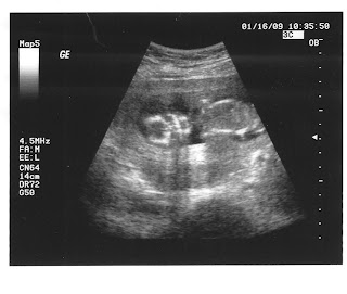 new: 14 week ultrasound pictures