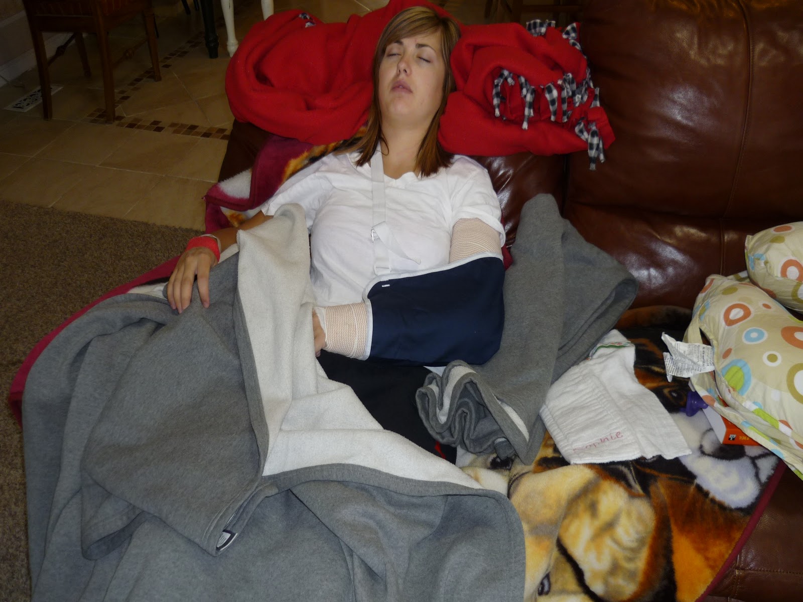 We are the Barker's: My broken arms!