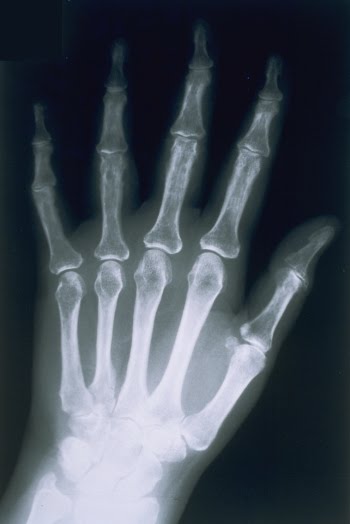 Science Class and More: Album : Invisible Light