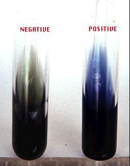 Biochemical Tests: Citrate Test