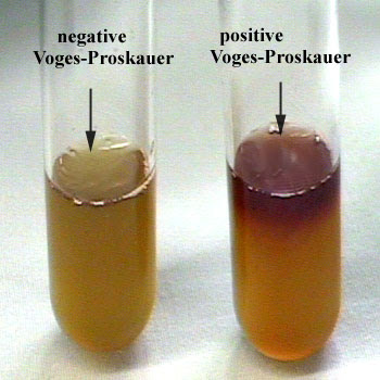 Biochemical Tests: The Methyl Red Test & Voges-Proskauer Test