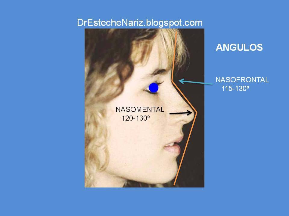 Dr Esteche | Rinoplastia | Cirugía | Plástica de Nariz | Nose |Surgery ...