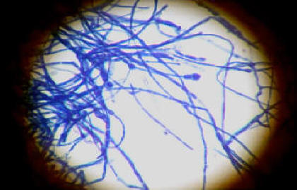 Amantes de la Micologia: noviembre 2010