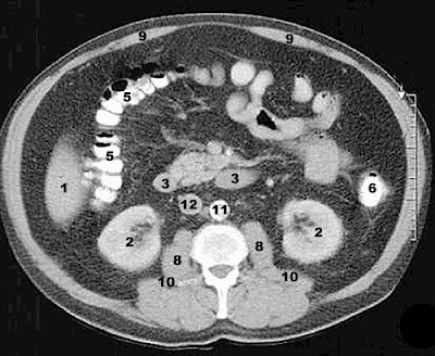 CT PHYSICS 09: Cross-sectional CT images of the abdomen