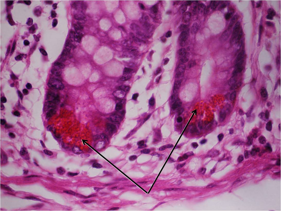 se denominan células de