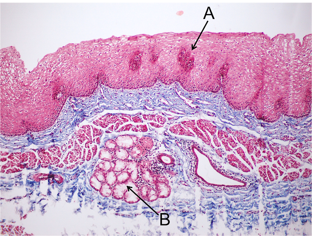 SOS BIOLOGIA CELULAR Y TISULAR: TEJIDOS. EPITELIOS. ESOFAGO. Epithelial ...
