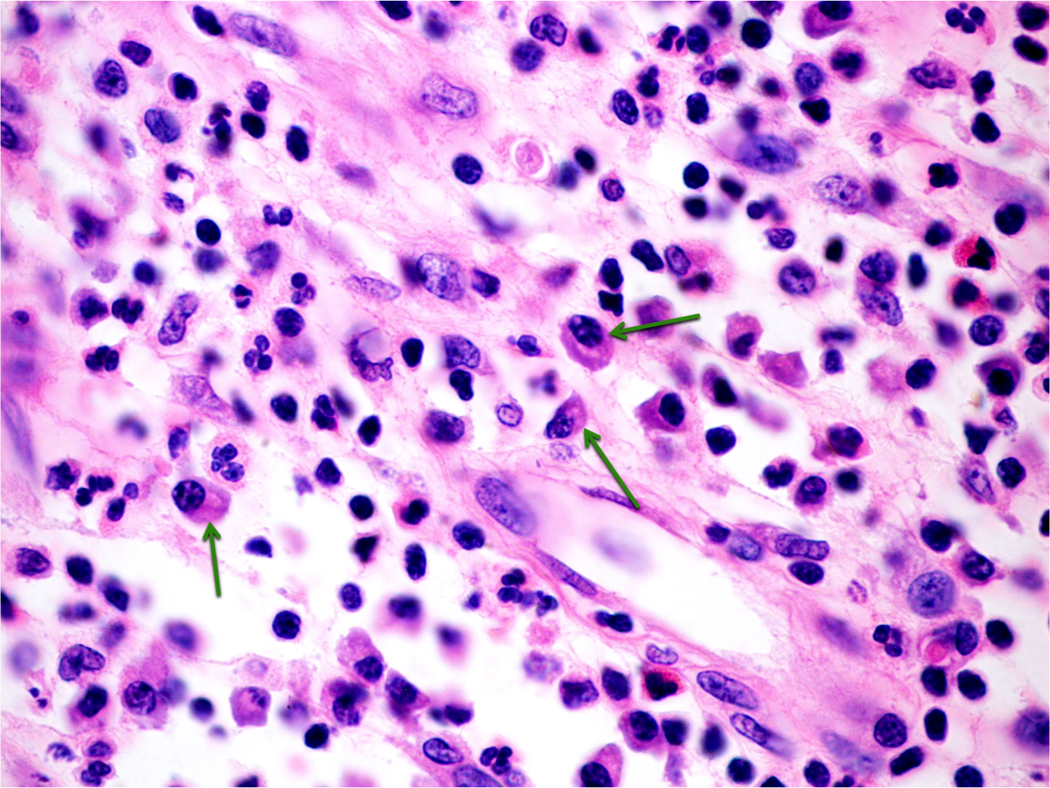 SOS BIOLOGIA CELULAR Y TISULAR: TEJIDOS. CONECTIVO. CELULAS