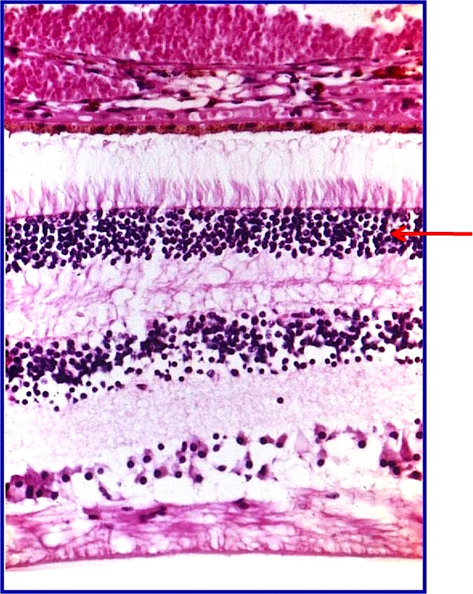 SOS BIOLOGIA CELULAR Y TISULAR: HISTOLOGIA DEL OJO. RETINA