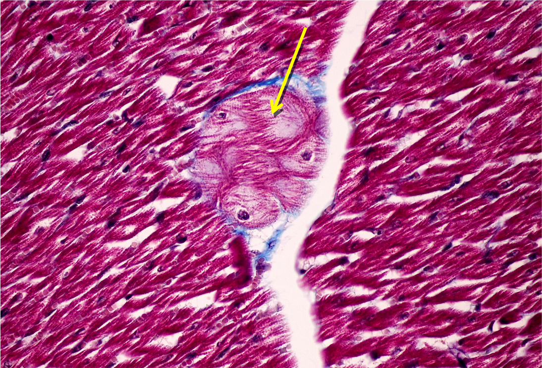 SOS BIOLOGIA CELULAR Y TISULAR: HISTOLOGIA. CORAZON 1