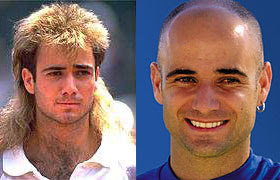 No Hype: Where did the hair go?????