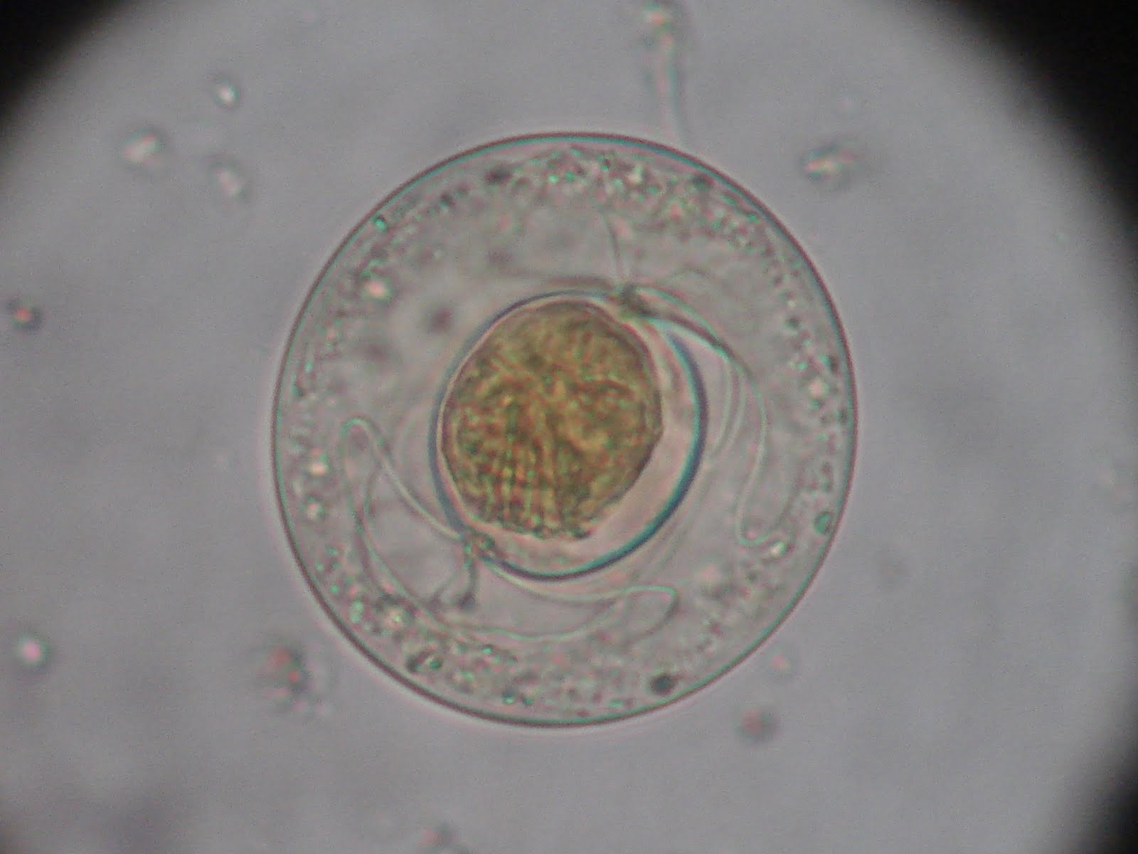 InBiomediks: Helmintos