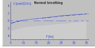IOS Impulse Spirometry- quick, quiet, and cooperation free.: IOS ...