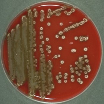 BACILLUS SUBTILIS