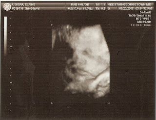 BabyUbiera: 4D ultrasound - 34 weeks