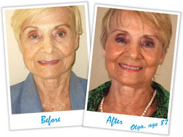 LifeCell - Skin Care and Anti Aging Treatment: LifeCell Skin Care ...