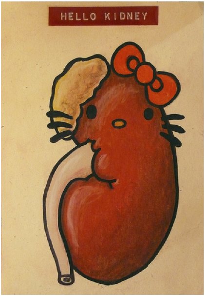 Daily Lessons from Medical School: Hello Kidney