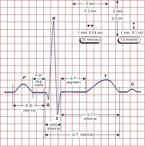 Electrocardiograma: Ondas que componen el Electrocardiograma