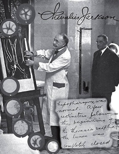 Chevalier Jackson - Alchetron, The Free Social Encyclopedia