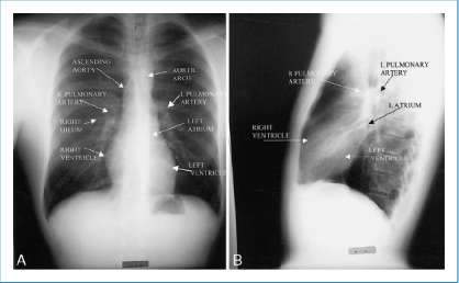 Cardiology secrets: All About Chest Radiographs
