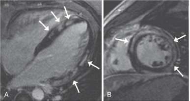 Cardiology secrets: Diagnosis of heart: Cardiac Magnetic Resonance Imaging.